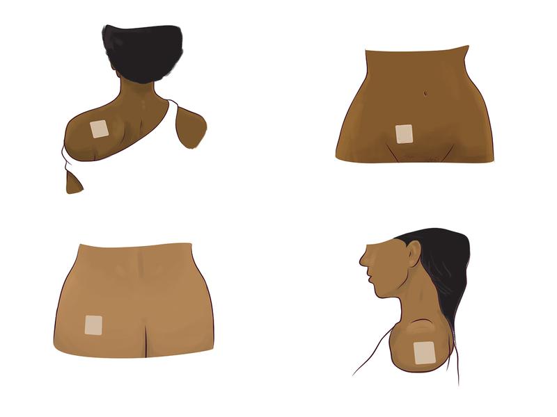 Contraceptive Patch Evra