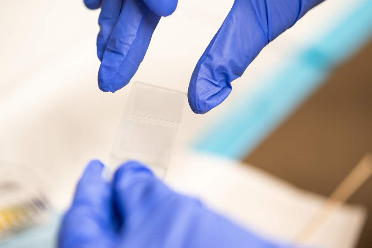 How to Get Tested for STIs At Home | Planned Parenthood Great Rivers